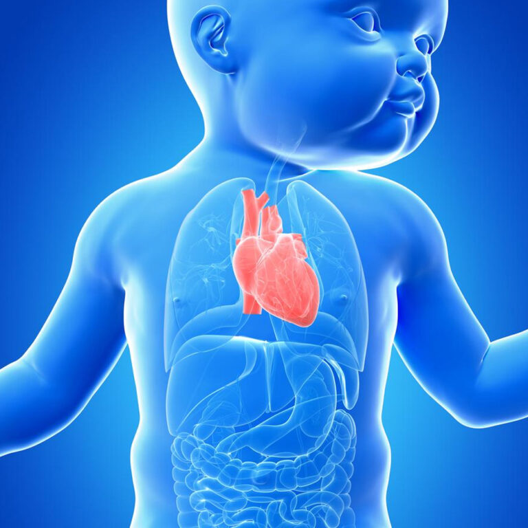 Cardiopatías Congénitas Sociedad Ecuatoriana De Cardiología